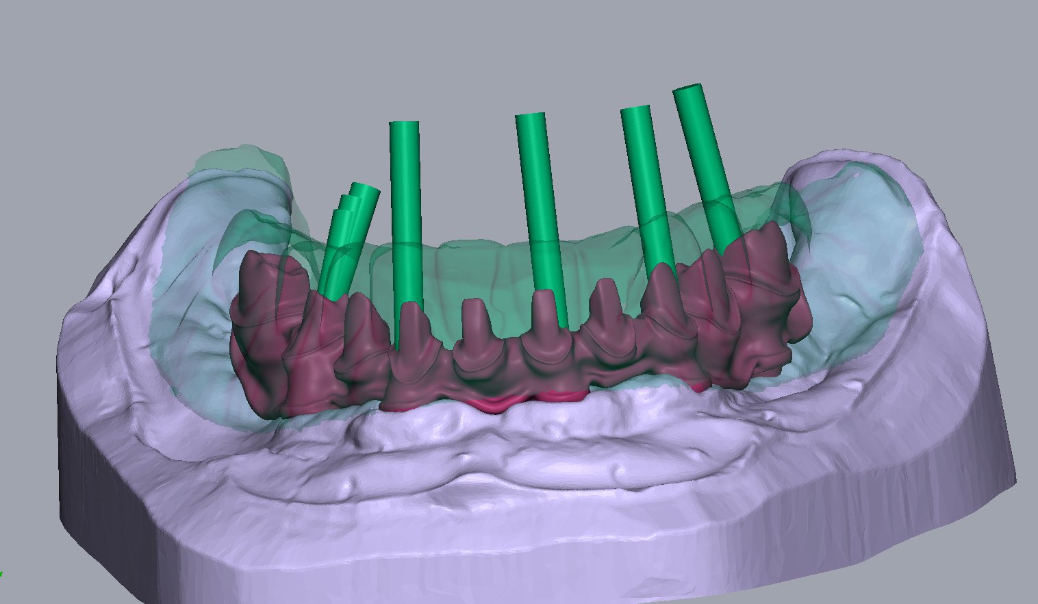 Design - Intellident