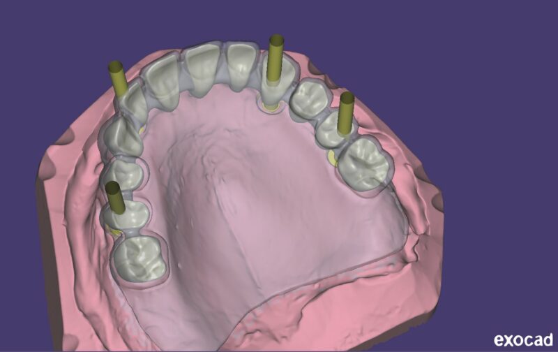 Design - Intellident
