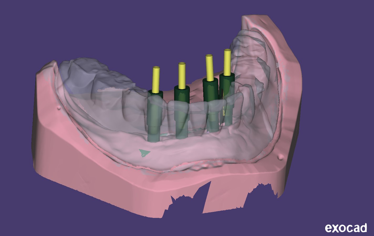 Titanium bar with secondary structure