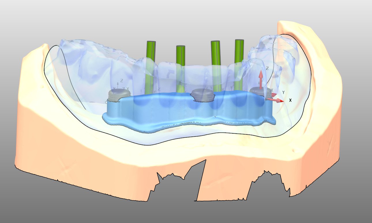 Titanium bar with secondary structure